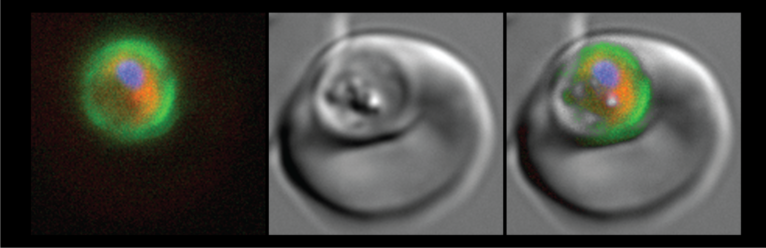 Generation of a ‘mutator’ Plasmodium parasite to understand ...